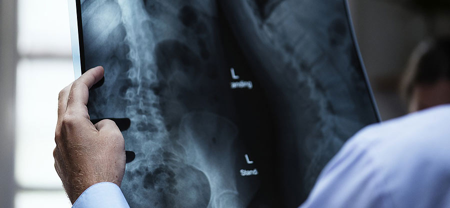 Radiologie conventionnelle près d’Angoulême et en Charente